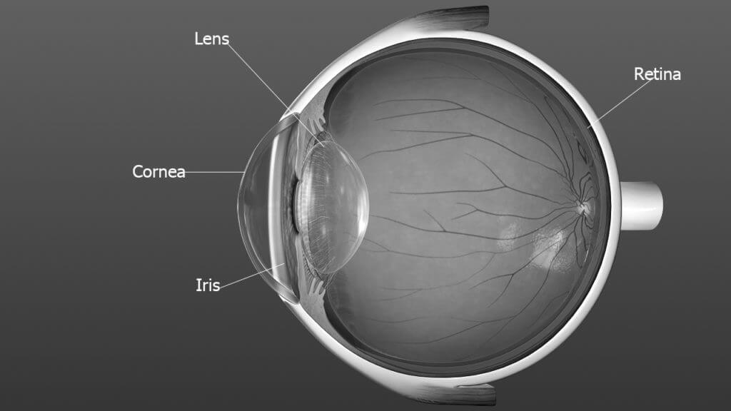 Cataract - Causes and Treatments - Wills Eye Hospital, Philadelphia, PA